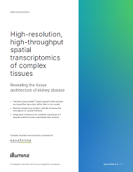 High-resolution, high-throughput spatial transcriptomics of complex tissues