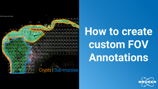 How to Add Custom FOV Annotations in the AtoMx® SIP