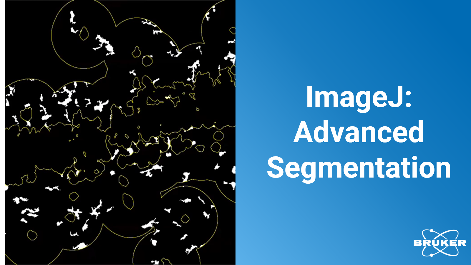 Advanced Segmentation Using ImageJ