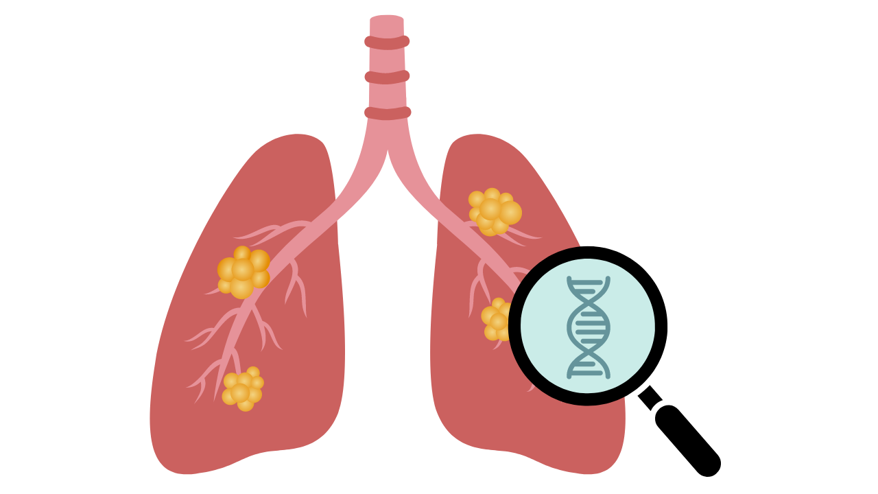 5 Things to Know About Biomarker Testing