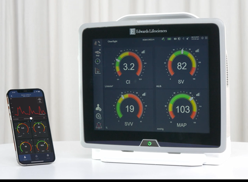 Intermittent Cardiac Output Monitoring Setup And, 44% OFF