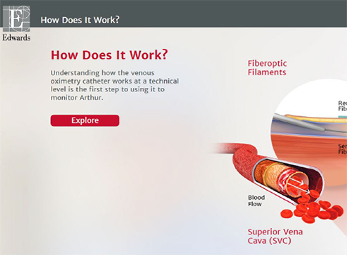 Edwards Oximetry Central Venous Catheter (EOCVC) eLearning Module ...