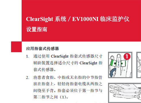 ClearSight系统／EV1000NI临床监护仪 设置指南
