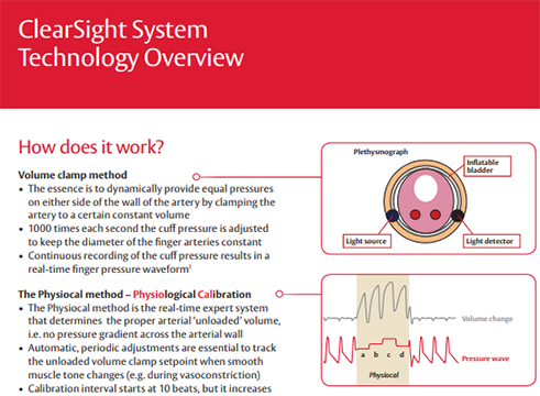 Edwards clinical education - Edwards Lifesciences